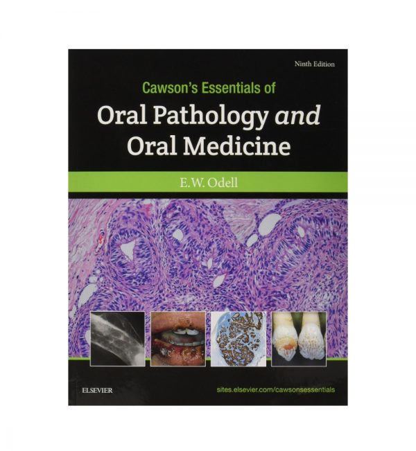Cawson's Essentials of Oral Pathology And oral Medicine 9th Edition – Fareed Book Centre